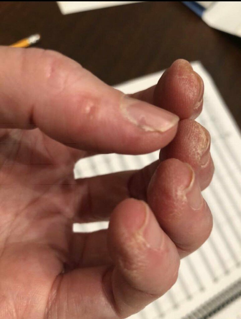 Why Being a Musician Can Be a Pain In the Neck