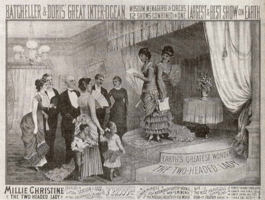 Millie and Christine McCoy: The Two-Headed Nightingale